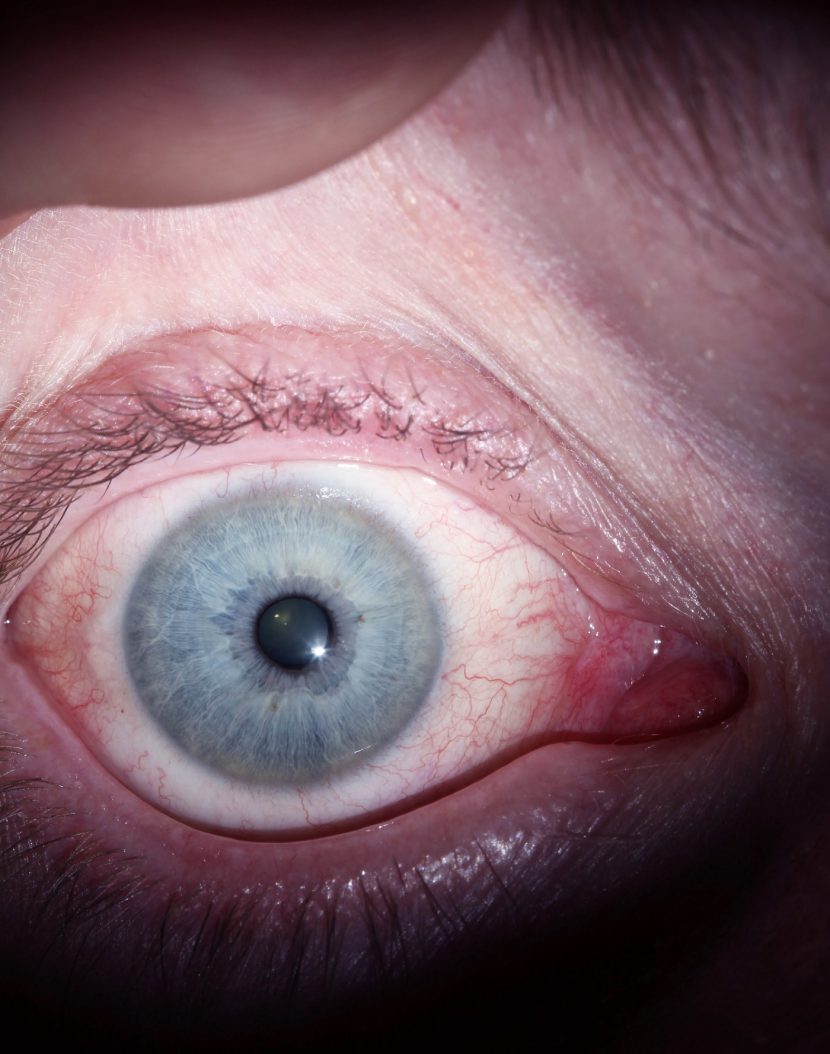 The eyes have it - fxguide